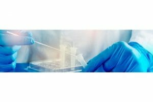 What Is A BBL Culture Swab Used For? - RespectCareGivers